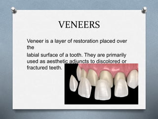 Types of Fixed Partial Dentures for BDS. | PPTX