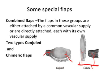 Two Types Of Flaps