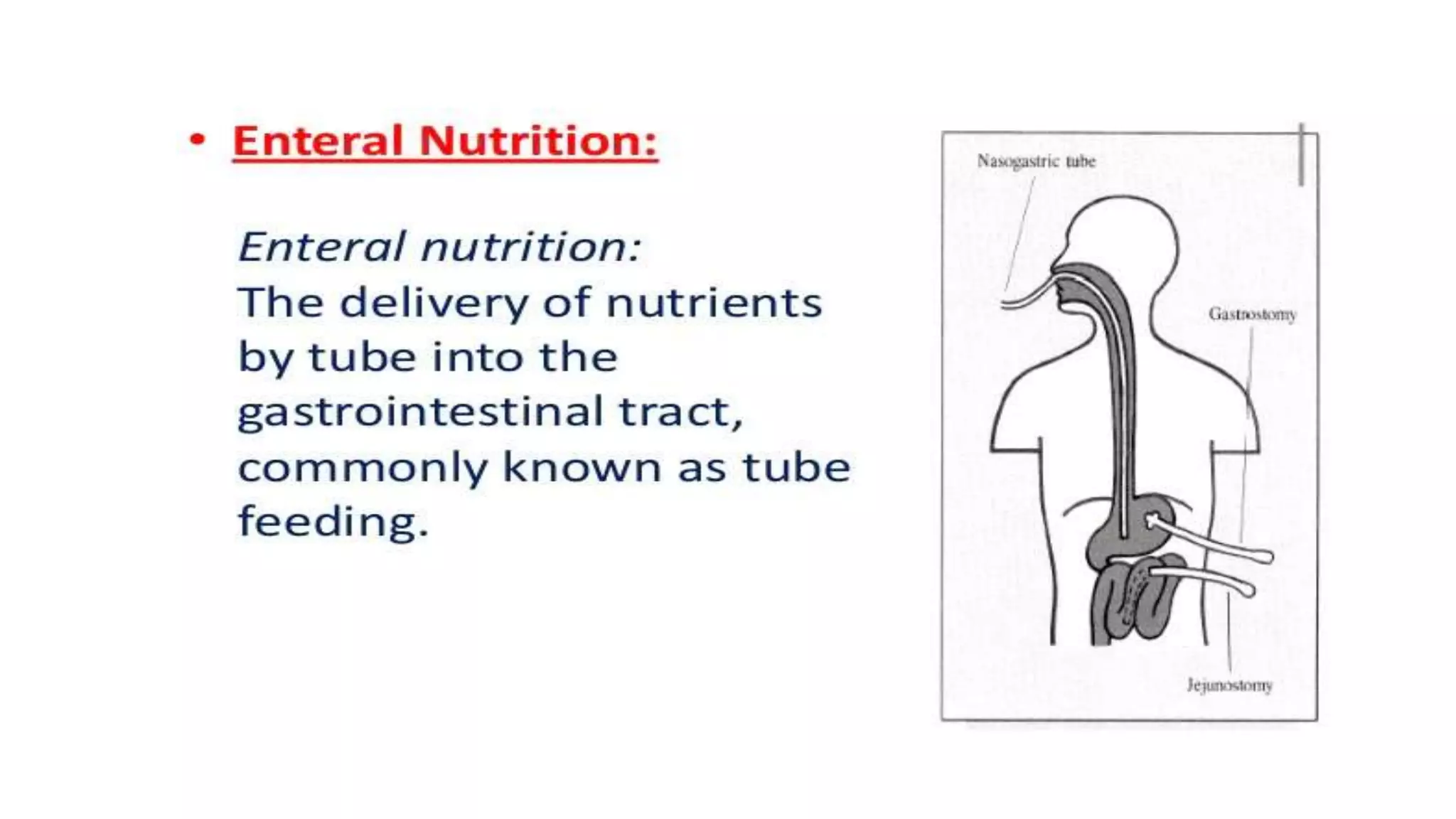 Types of formula for enteral nutrition L#13,14.pptx