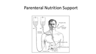 Types of formula for enteral nutrition L#13,14.pptx