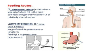 Types of formula for enteral nutrition L#13,14.pptx