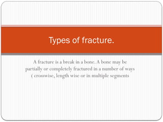 Types of fracture.pptx and must have info for physiotherapist | PPTX
