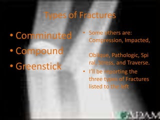 Types Of Fractures | PPTX