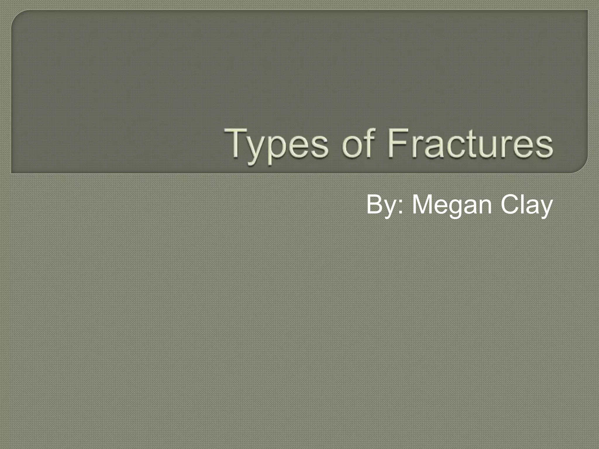 Types Of Fractures | PPTX