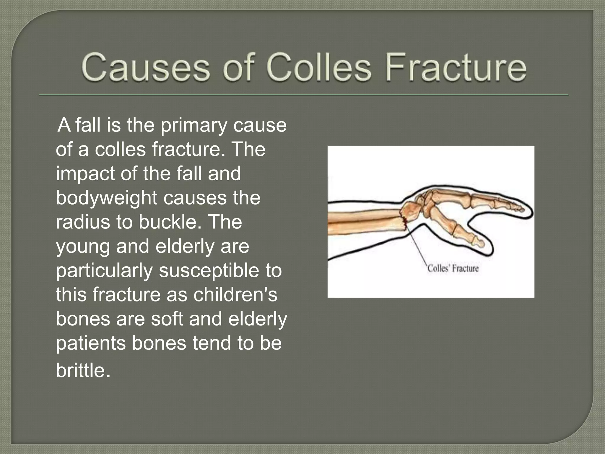 Types Of Fractures | PPTX