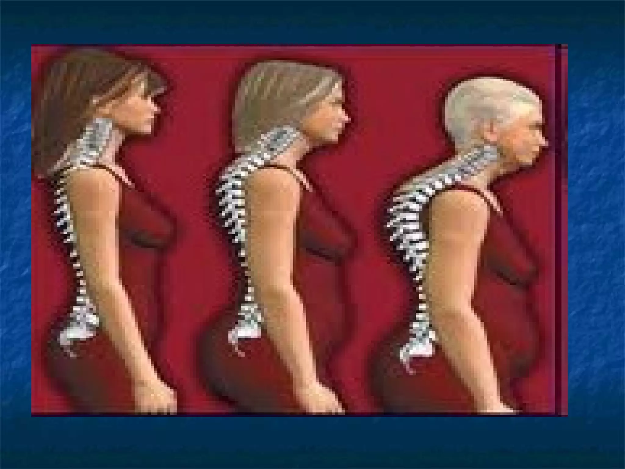common diseases/disorders of the skeletal system | PPT