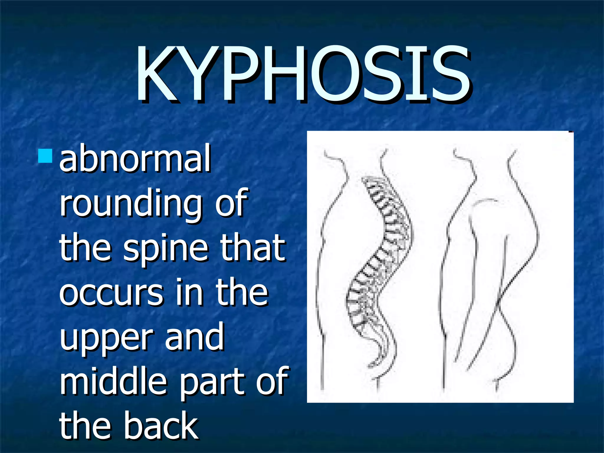 common diseases/disorders of the skeletal system | PPT
