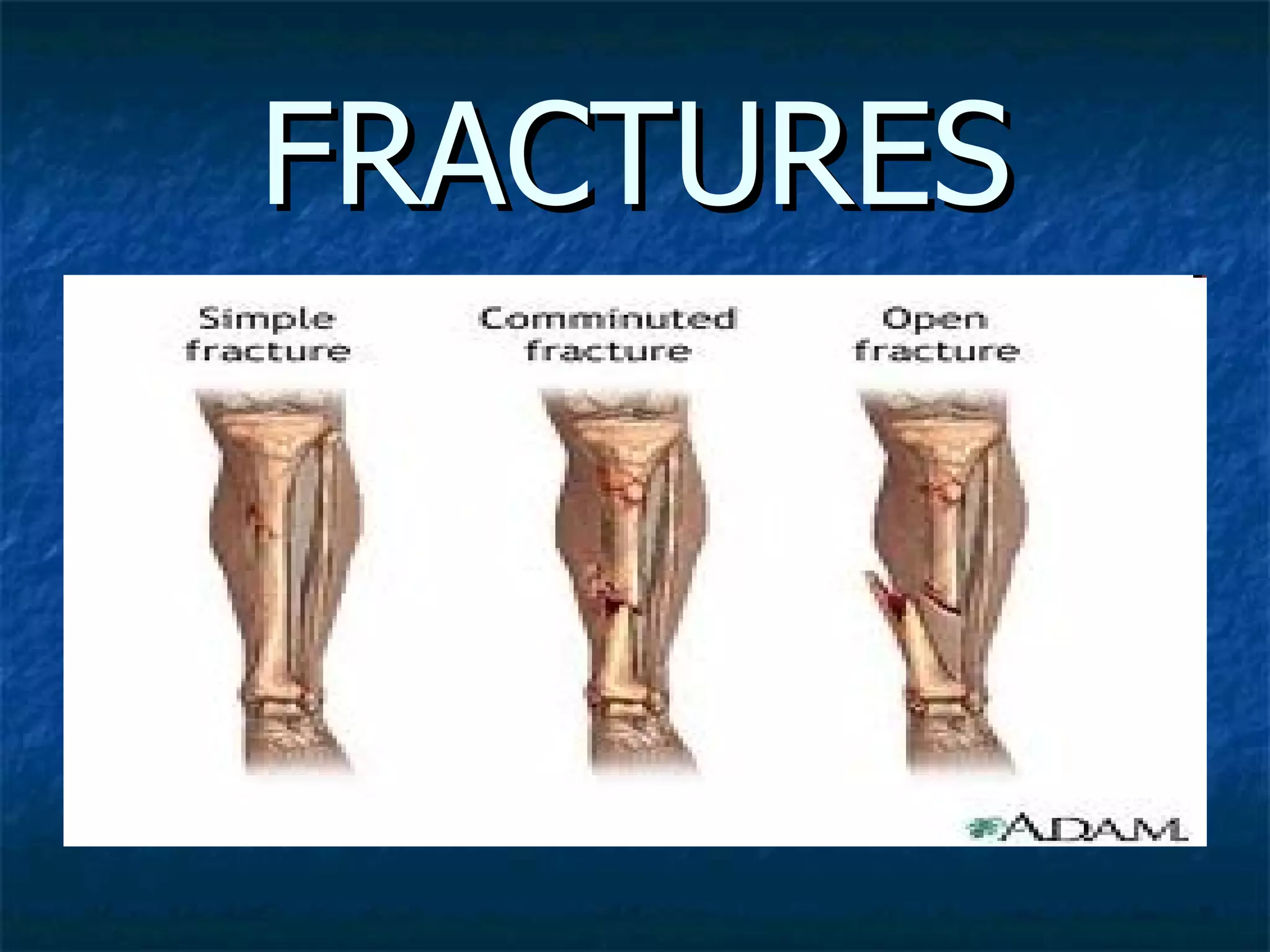 common diseases/disorders of the skeletal system | PPT