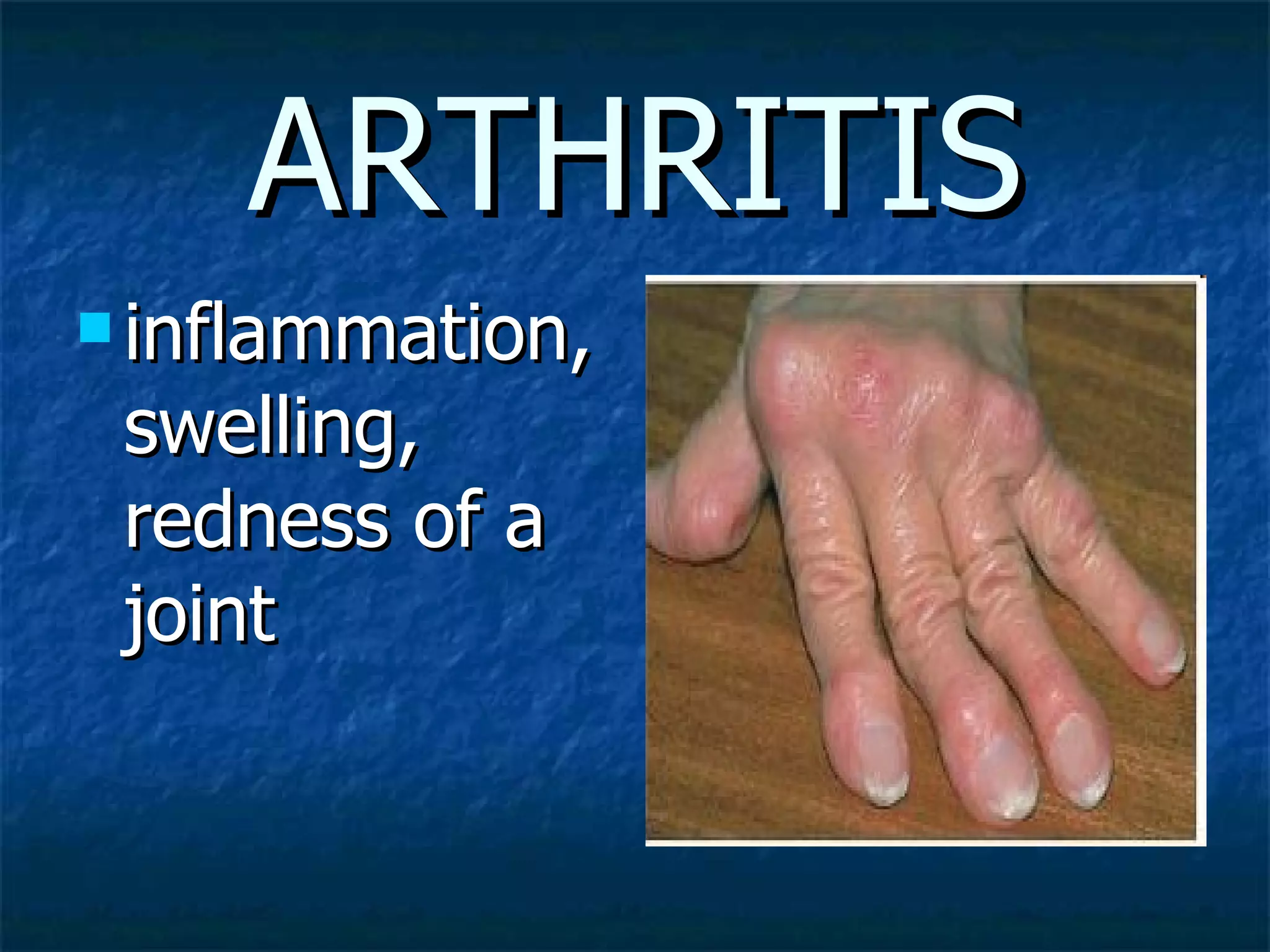 common diseases/disorders of the skeletal system | PPT