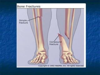 common diseases/disorders of the skeletal system | PPT