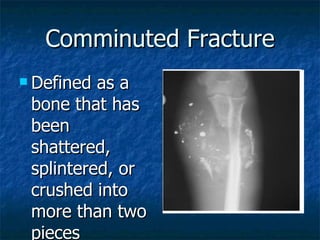 common diseases/disorders of the skeletal system | PPT