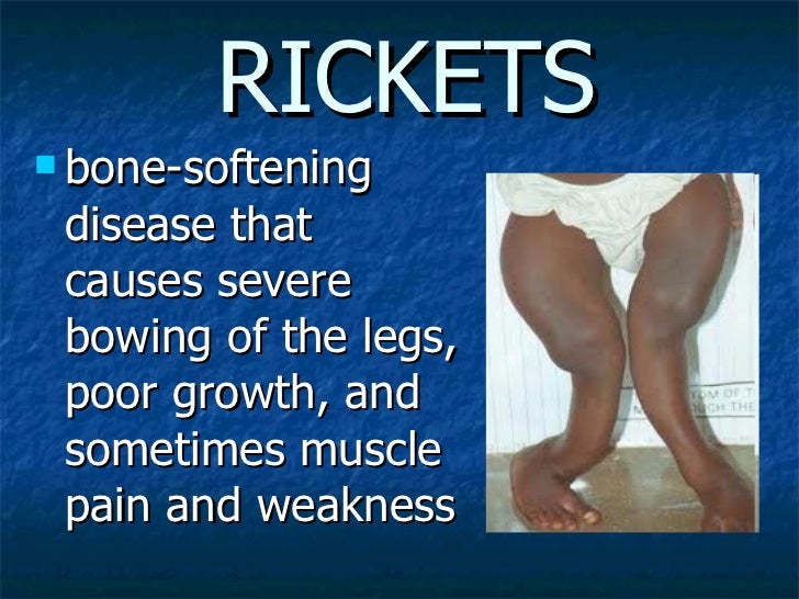 Common Diseases disorders Of The Skeletal System Common Diseases disorders Of The Skeletal System