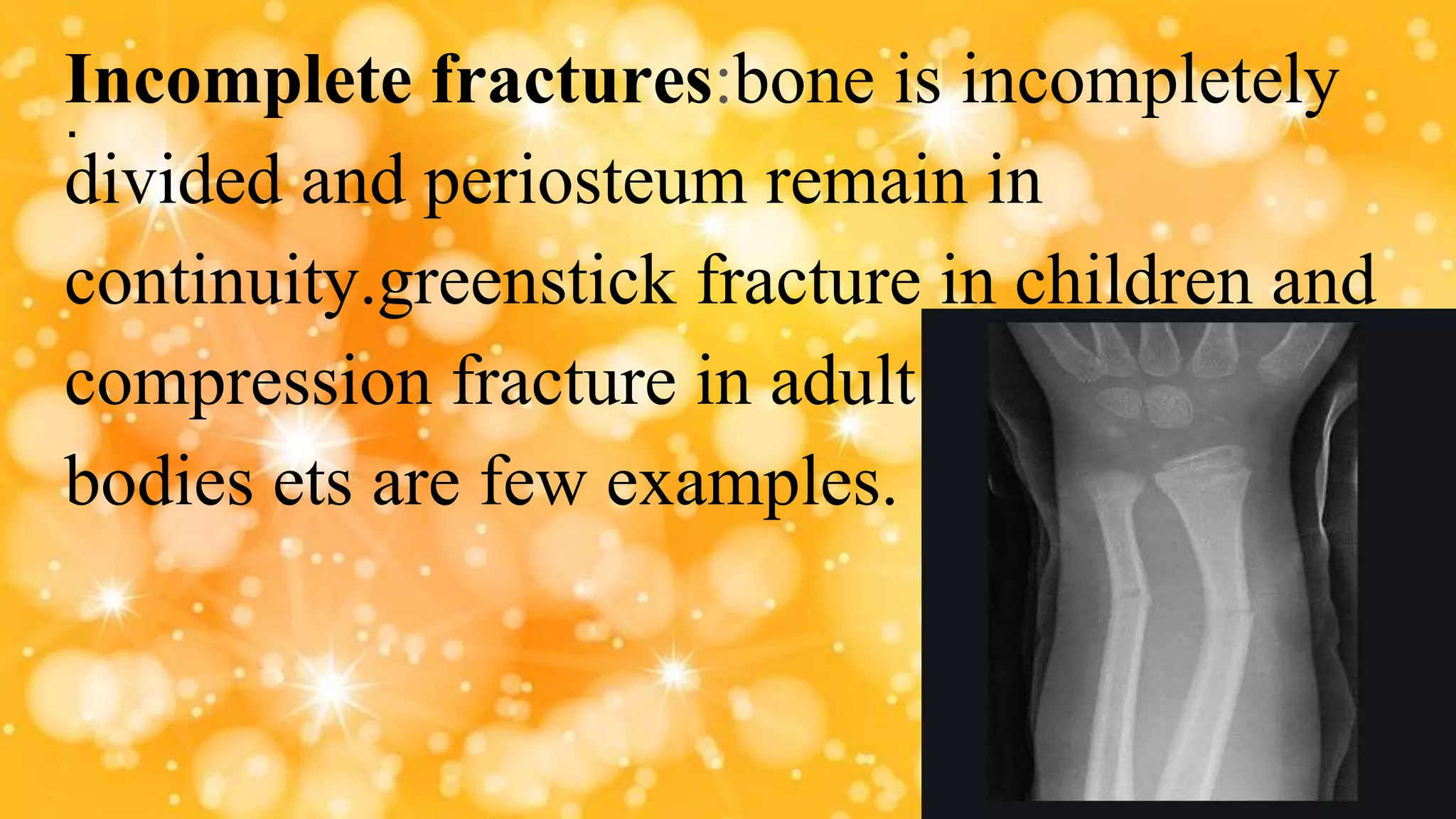 Types of fractures ,fracture healing stages and factors influencing ...