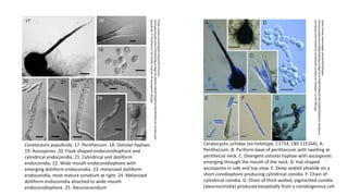 Types of fruiting bodies in fungi | PPTX