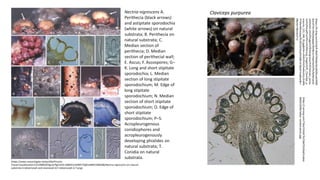 Types of fruiting bodies in fungi | PPTX