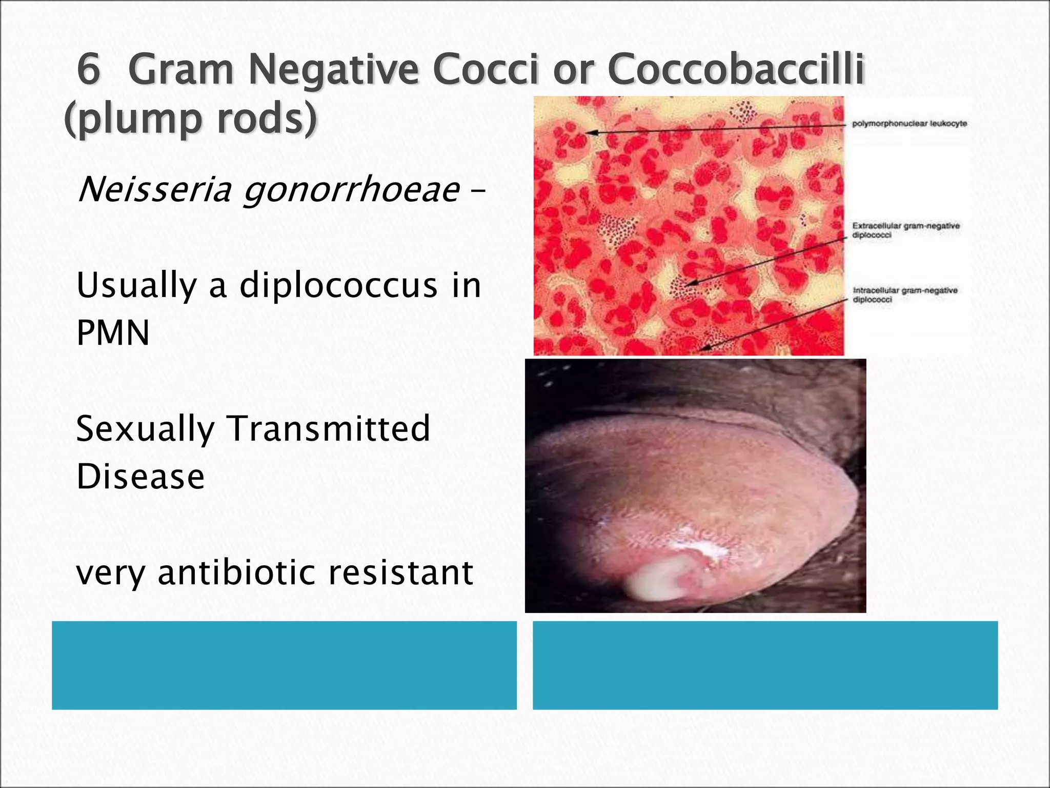 Types of gram negative bacteria.ppt