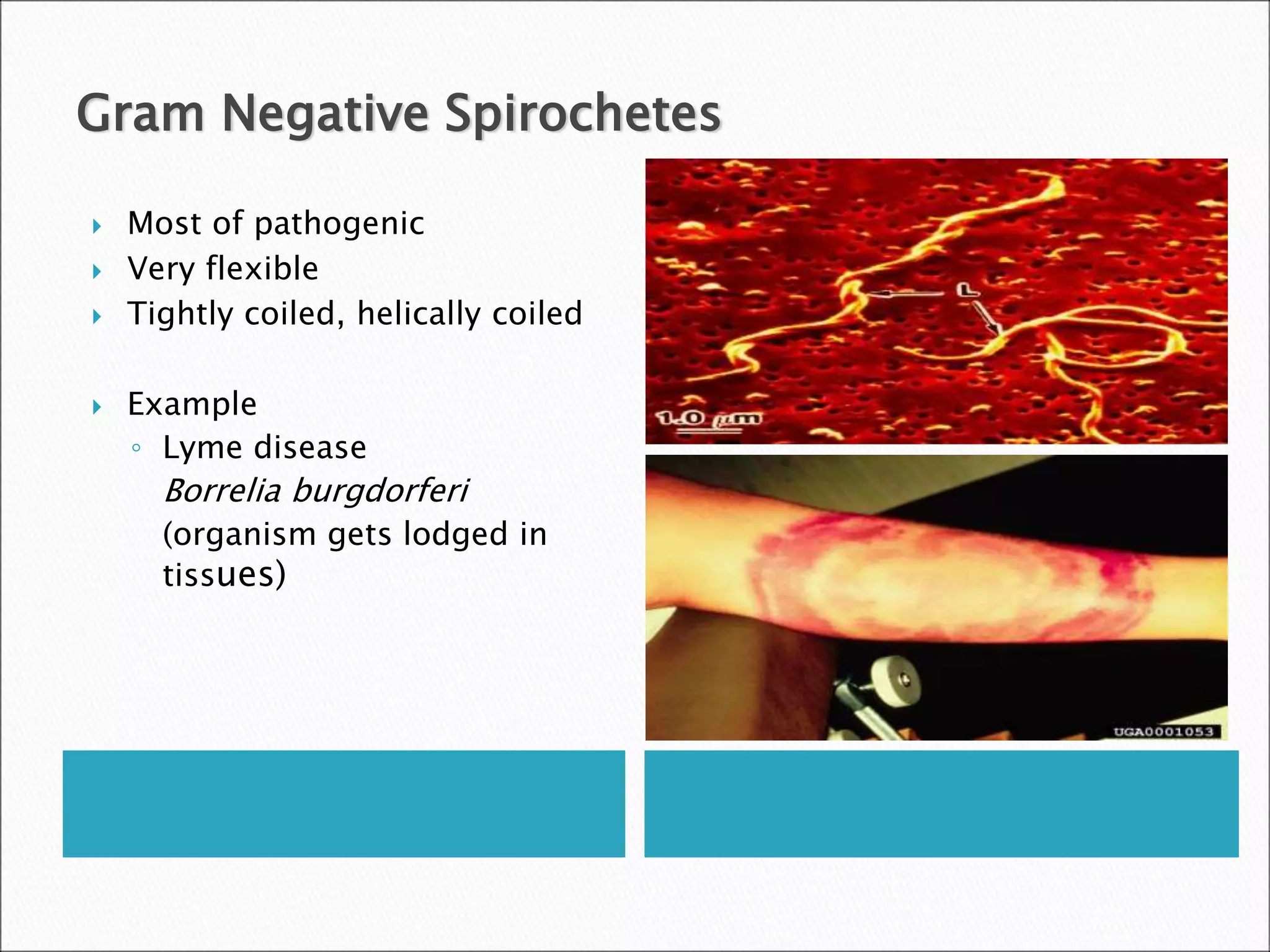 Types of gram negative bacteria.ppt