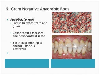 Types of gram negative bacteria.ppt