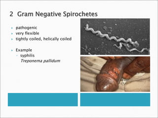 Types of gram negative bacteria.ppt