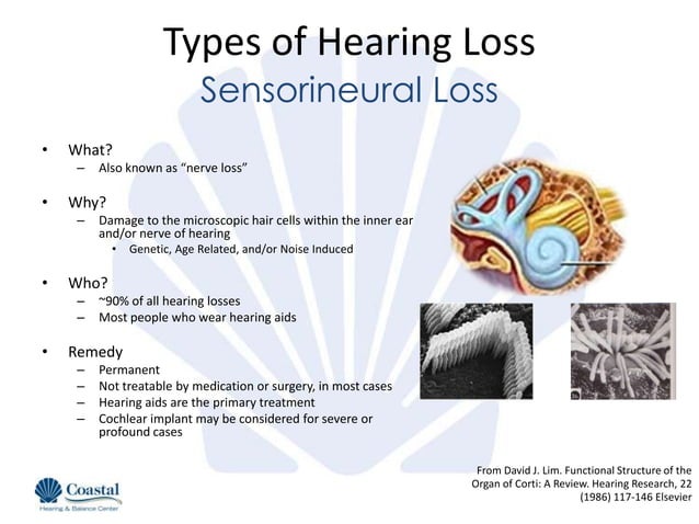 Types of Hearing Loss | PPSX