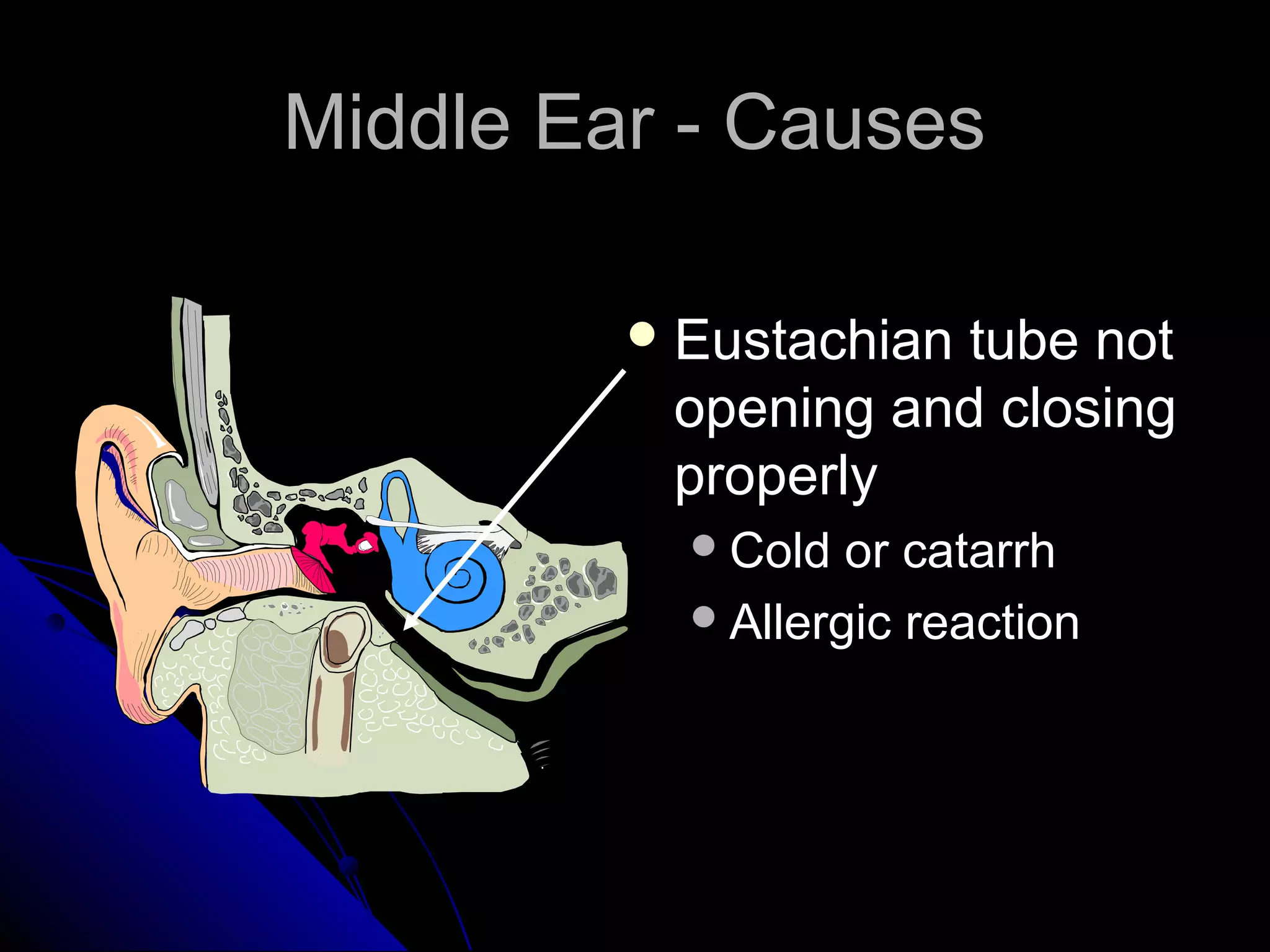 Types of hearing loss | PPT