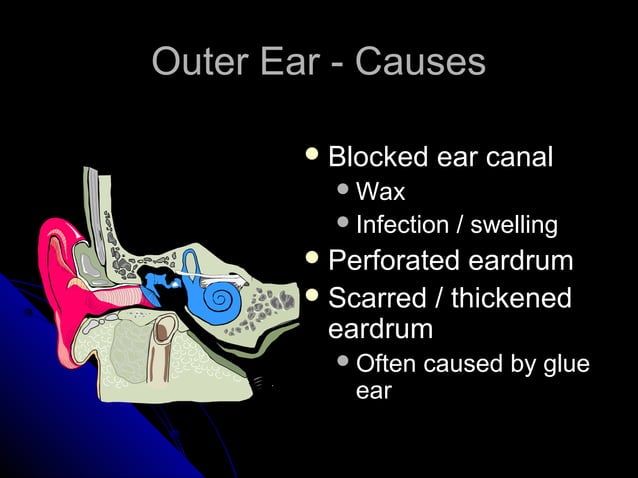 Types of hearing loss | PPT | Ear, Nose and Throat Conditions ...