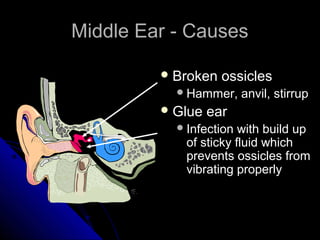 Types of hearing loss | PPT