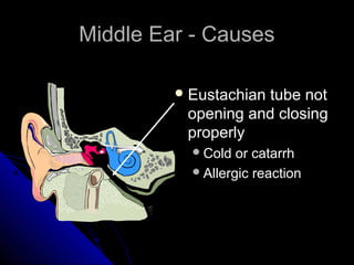 Types of hearing loss | PPT