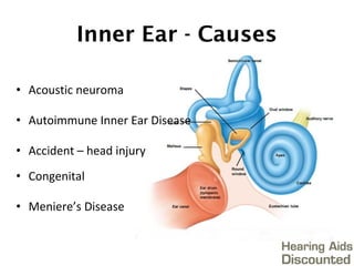 Types of hearing loss - Hearing Aids Discounted | PPT