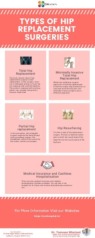 Types of hip replacement surgeries
