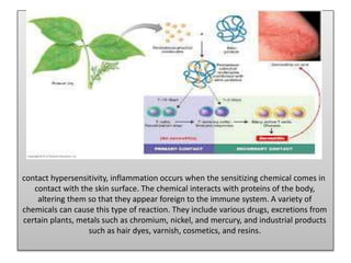 Types of hypersensitivity and analysis | PPT