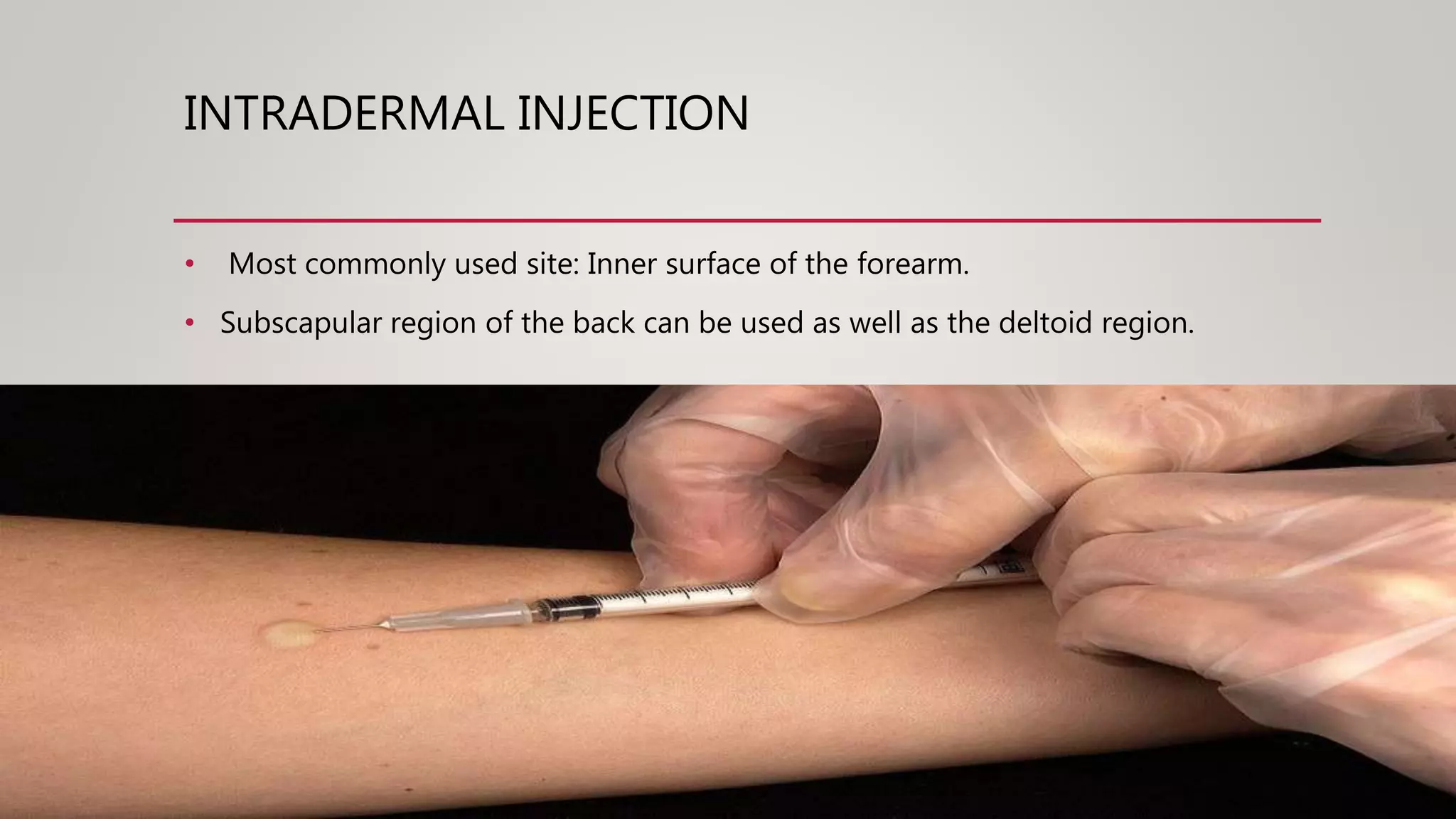 Types of injection | PPTX