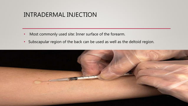 Types of injection | PPTX