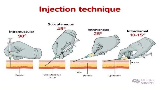 Types of injection