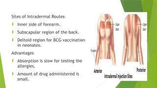 types of injection. Intravenous injection pptx | PPTX