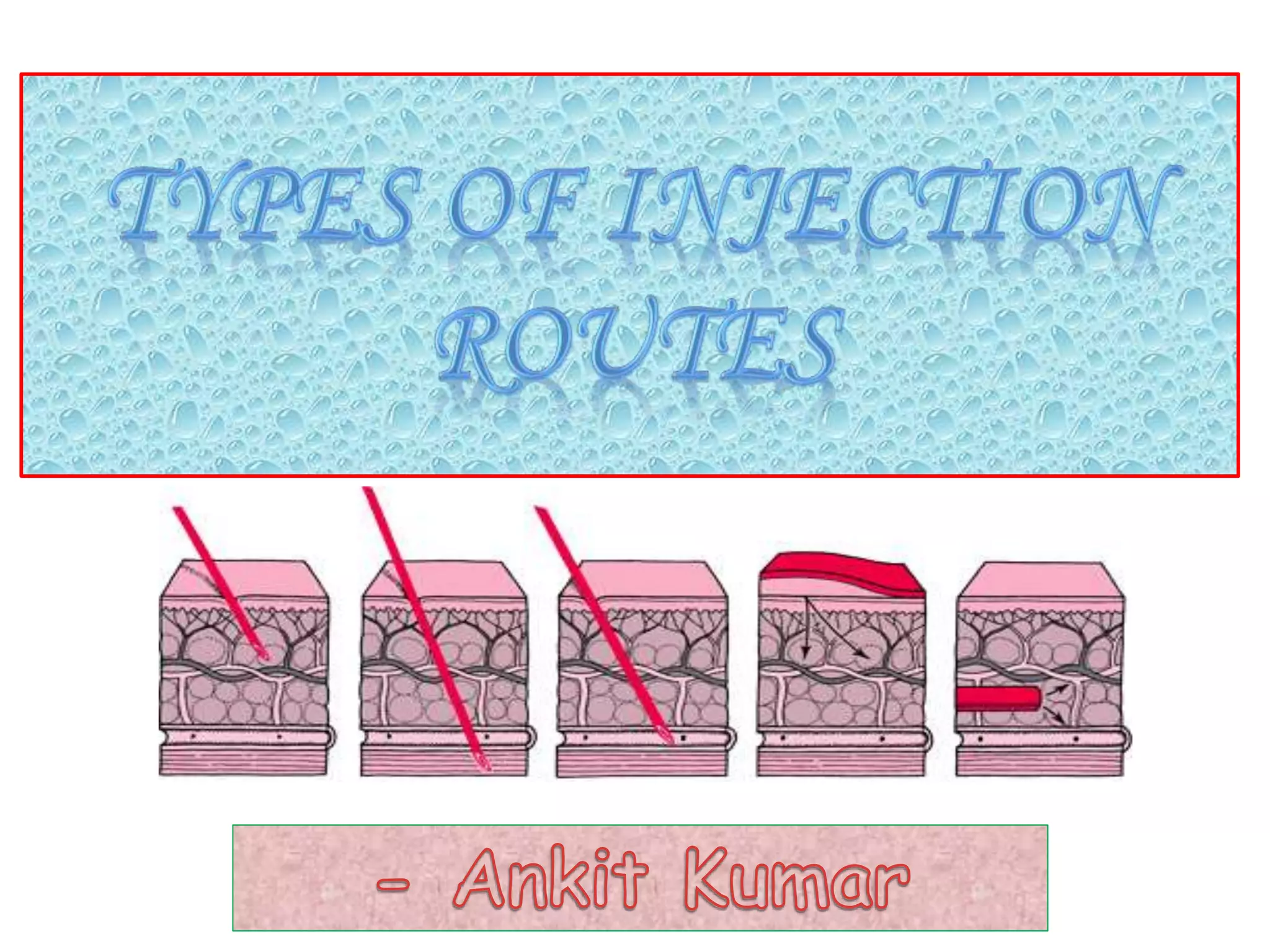 Types of injection routes | PPTX
