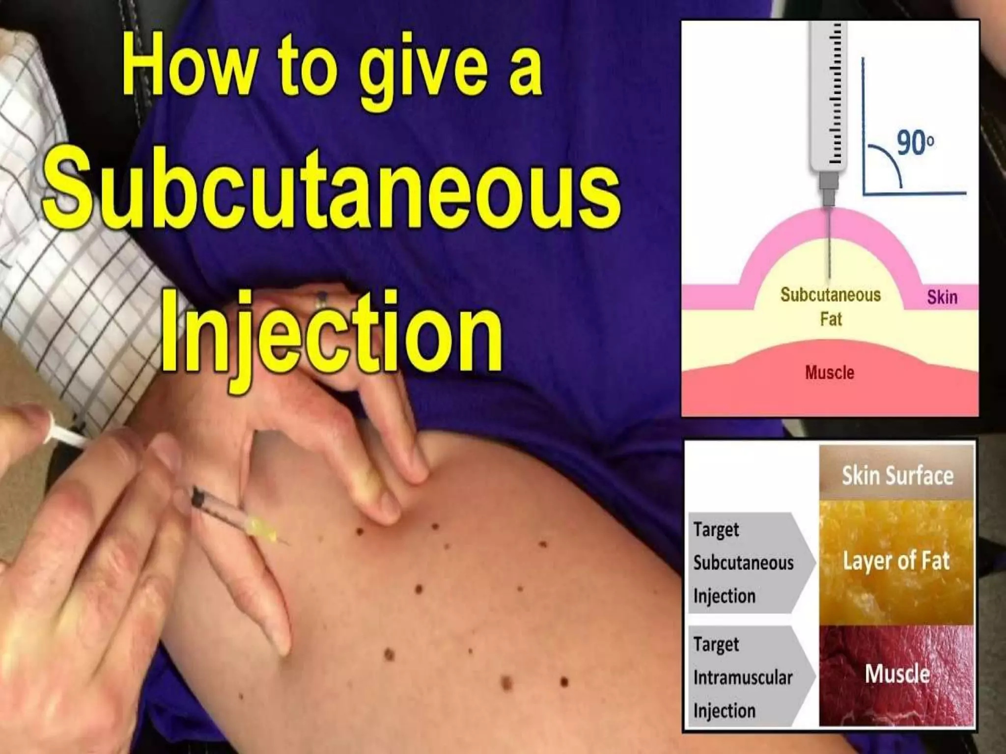 Types of injection routes | PPTX | Skin and Dermatology | Diseases and ...