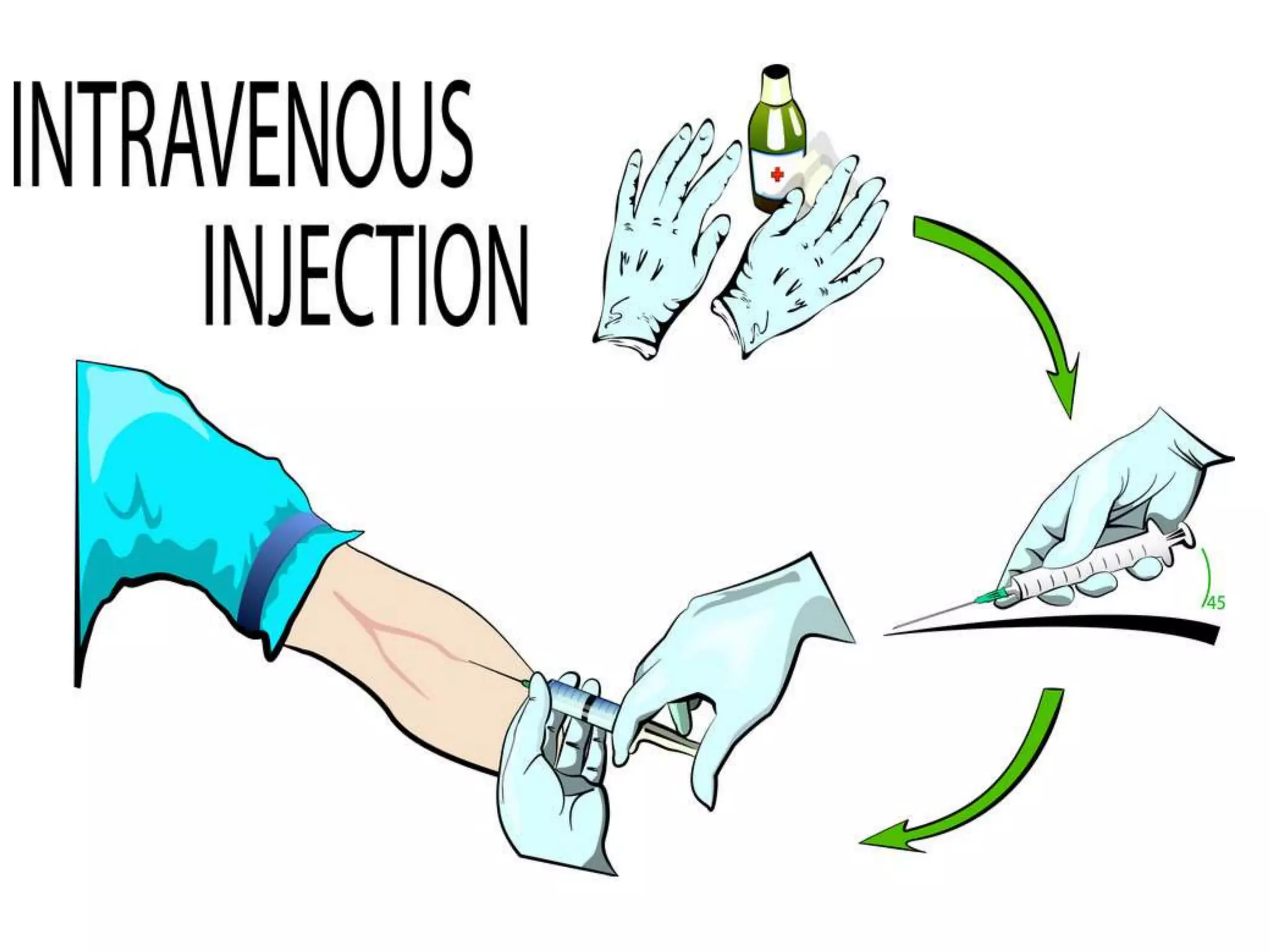 Types of injection routes | PPTX