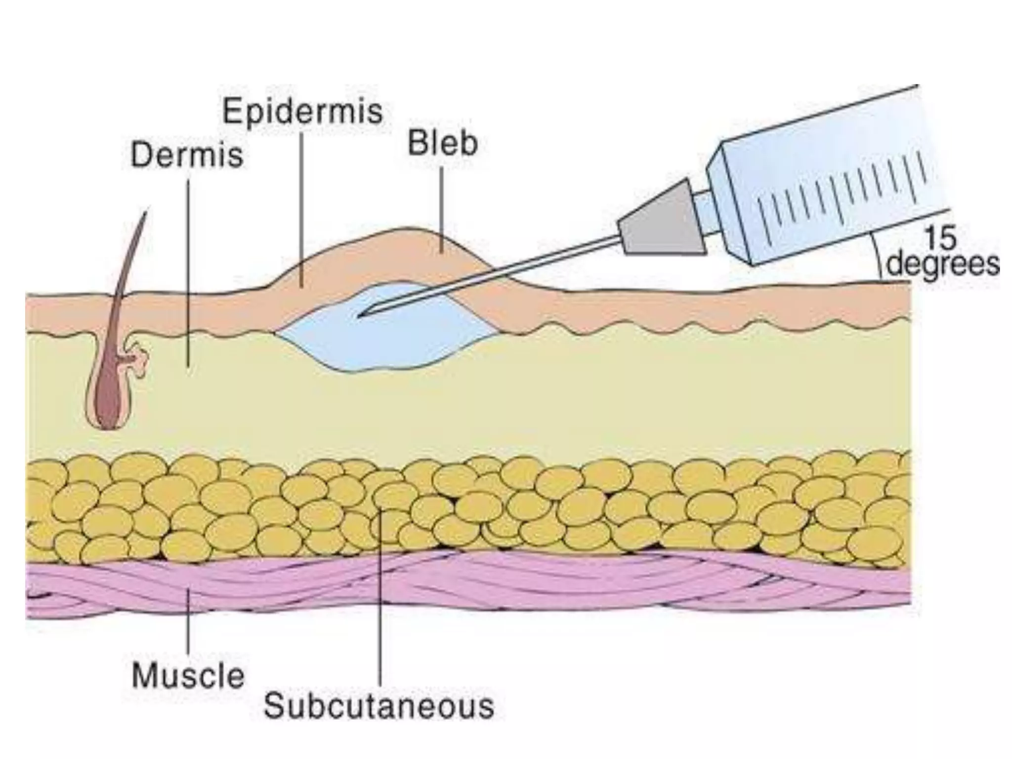 Types of injection routes | PPTX