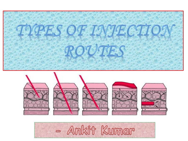 Types Of Injection Routes Ppt