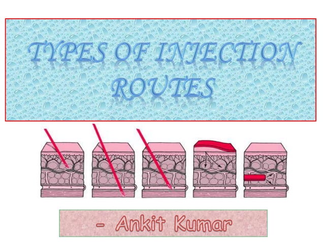 TYPES OF INJECTION AND INJECTION SITES.pptx | Skin and Dermatology ...