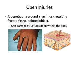 TYPES OF INJURIES AT CIVIL ENGINEERING SITE.pptx