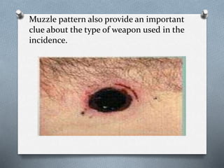 Types of injury and range of fire | PPTX