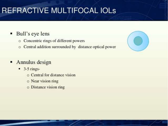 Types of iol | PPTX