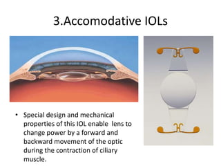 Types of iol | PPT