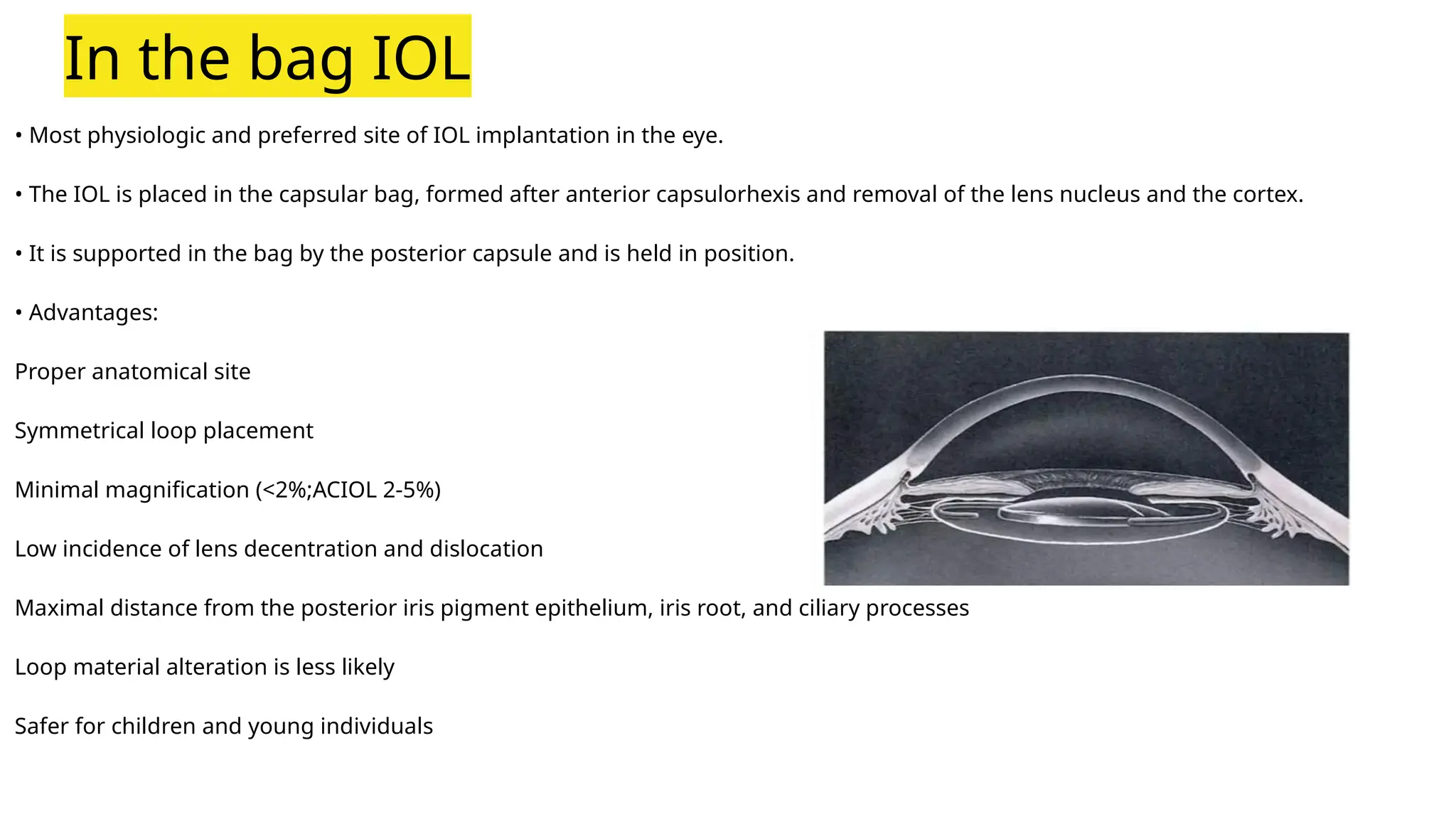 Types of IOL. Cataract instruments used it | PPTX