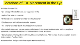 Types of IOL. Cataract instruments used it | PPTX