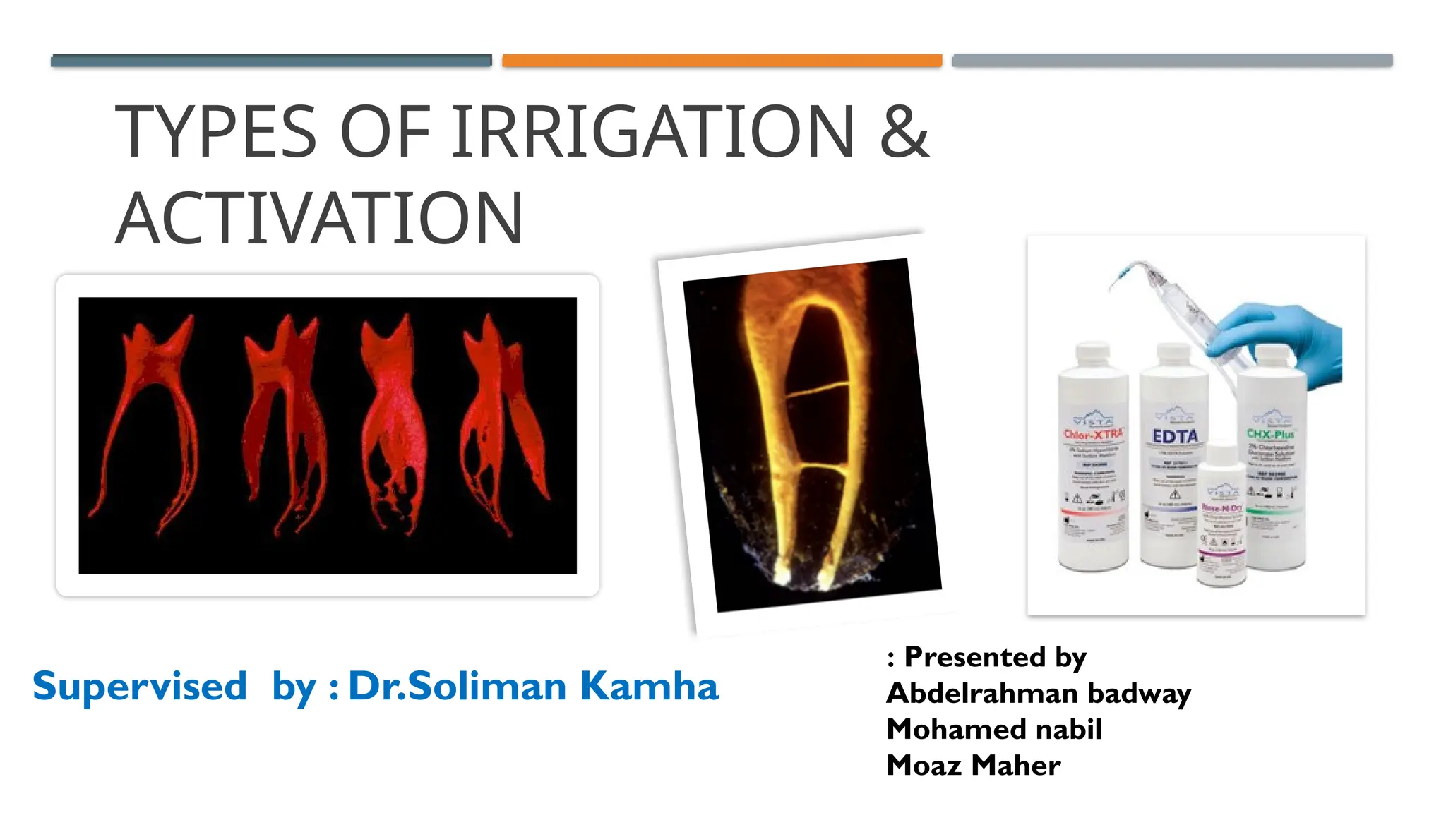 Types of irigation & activation in endodontic .pptx