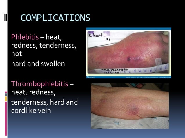 Types of iv fluids and uses