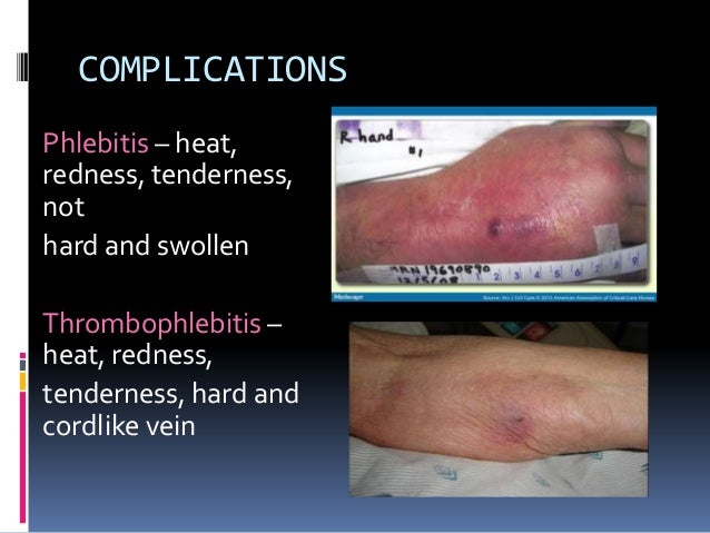 Types of iv fluids and uses